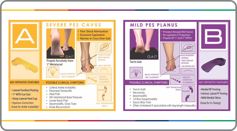 The Science Behind Forefoot Valgus: A & B Foot Types - Instructor: Rob ...