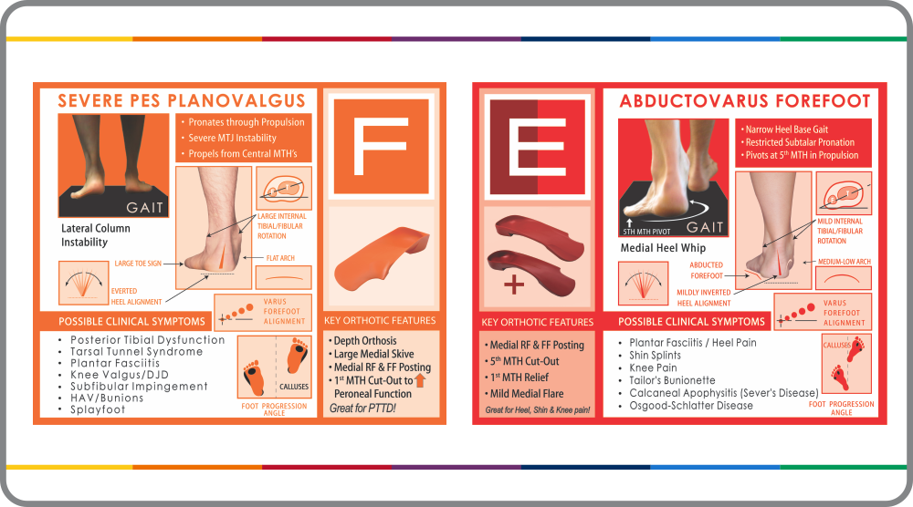 The Science Behind Forefoot Varus: E & F Foot Types - Instructor: Robe ...